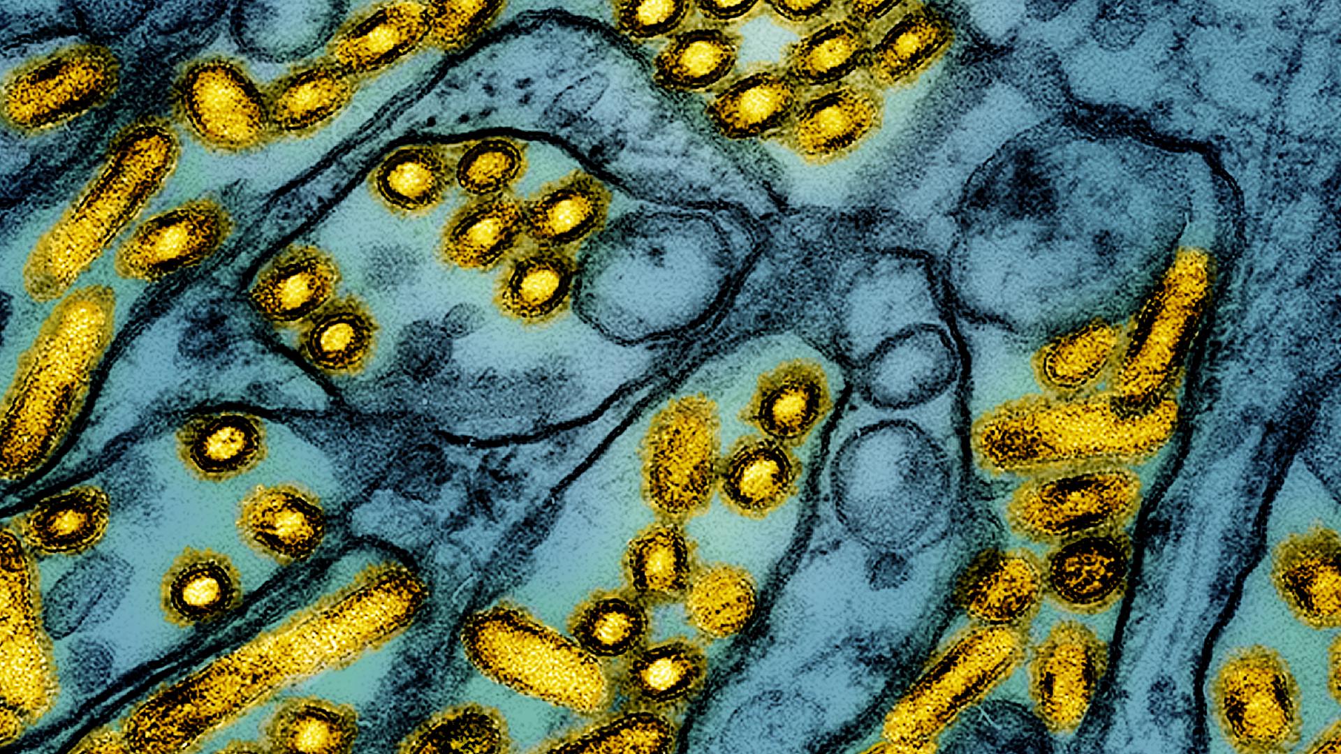 CDC bird flu update: Study prompts call for more testing on farms ... CDC bird flu update: Study prompts call for more testing on farms ...
