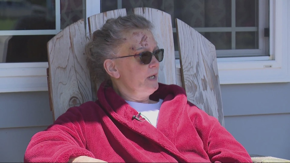 Hillsboro survives 300-foot fall near Dog Mountain Trail | krem.com