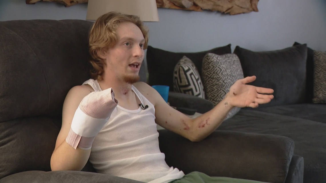 Washington teen loses hand in fireworks accident while protecting young ...