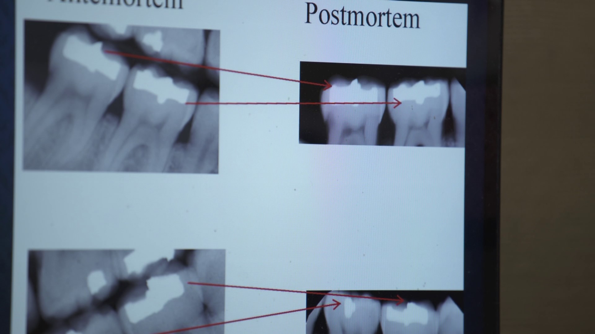 An inside look at WSP's forensic dental records system | krem.com