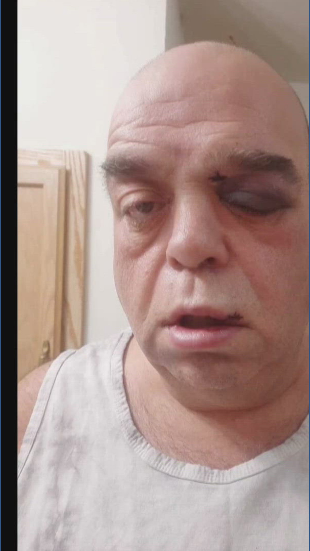 Cheney man injured in Spokane double-decker bus crash recovering from ...
