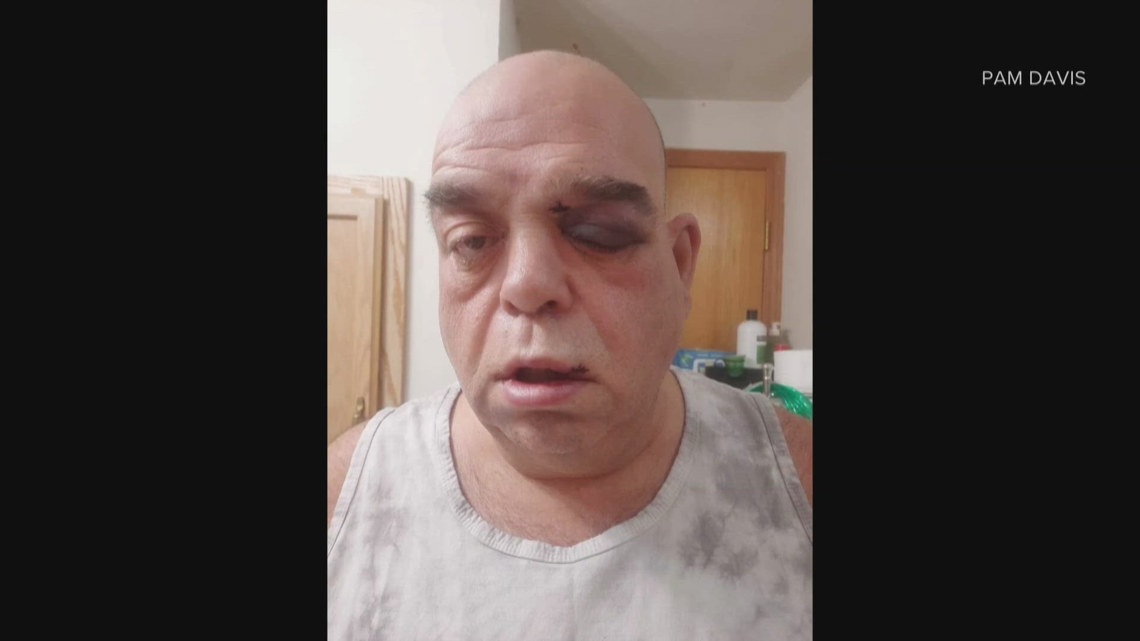 Cheney man injured in Spokane double-decker bus crash recovering from ...