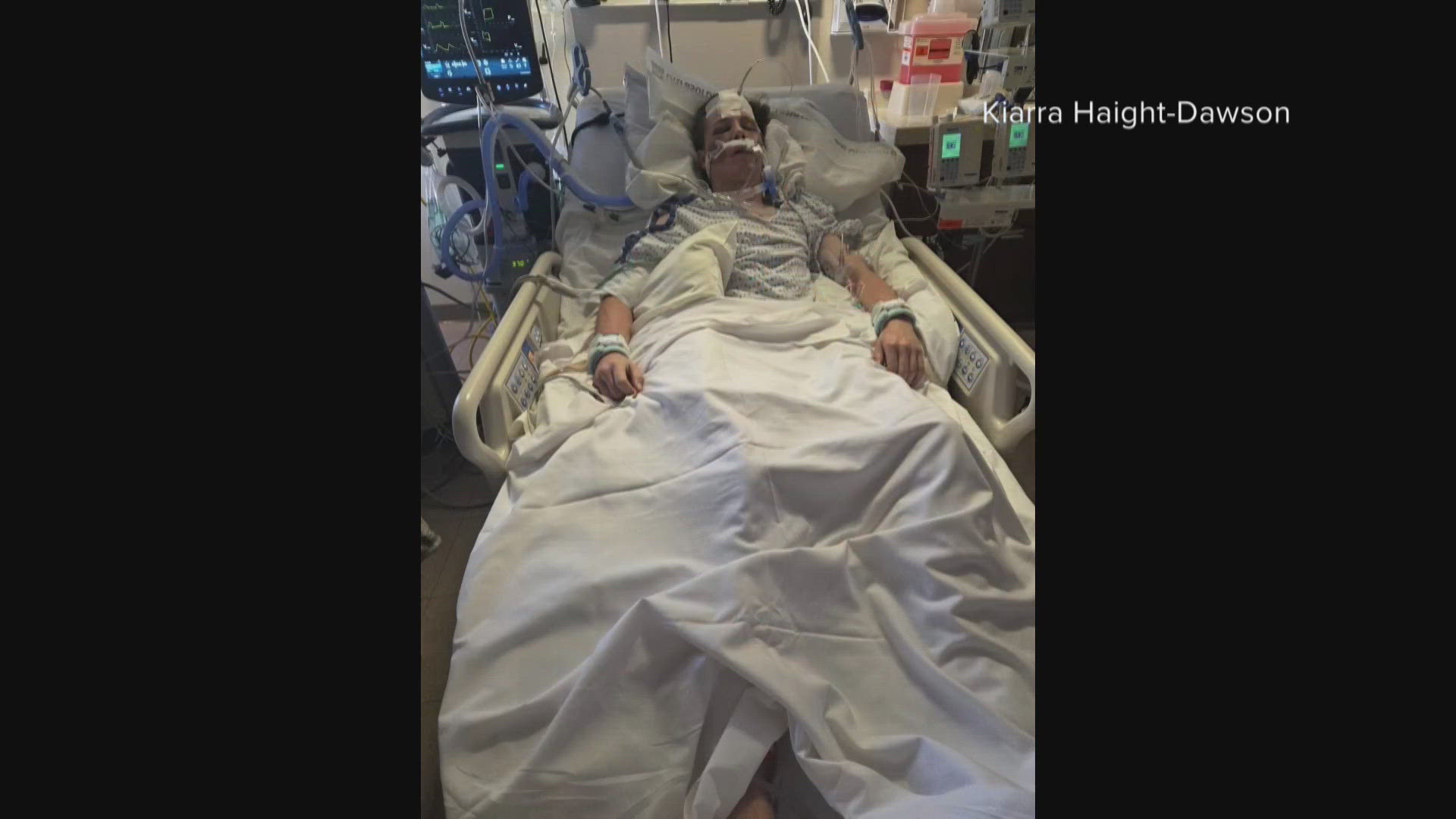 University of Idaho fight leaves food delivery driver 'fighting for his life' | krem.com