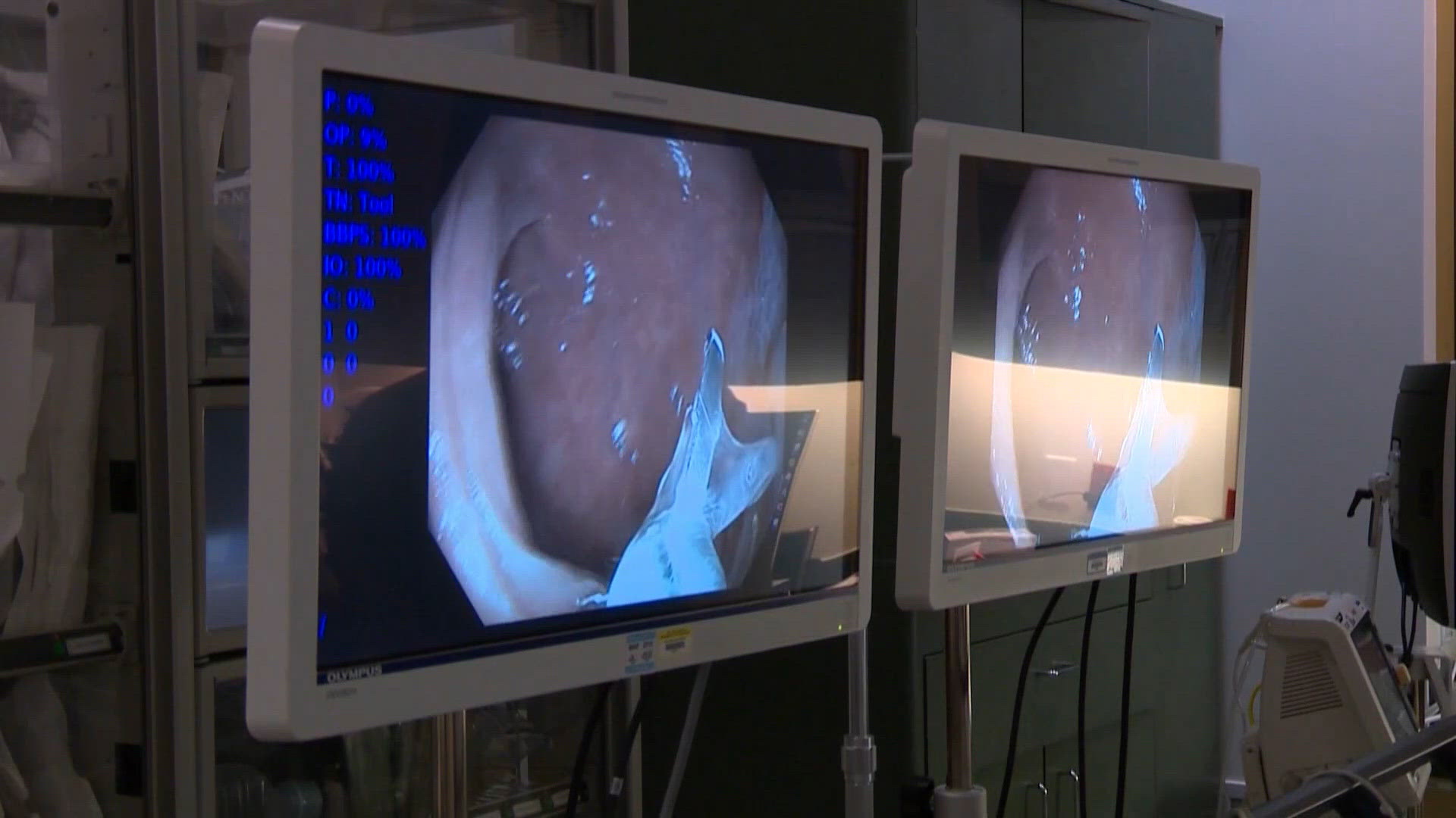 New Colorectal Cancer screening guidelines | krem.com