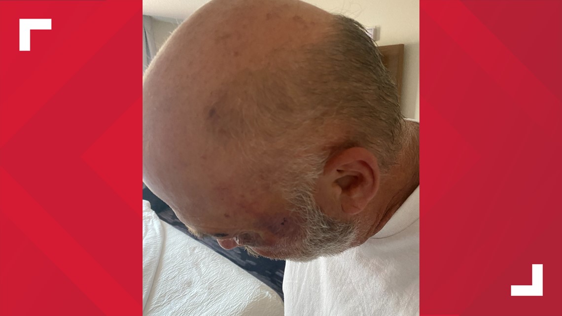 'The most egregious abuse of power' | Lawyers of man beaten by Spokane ...